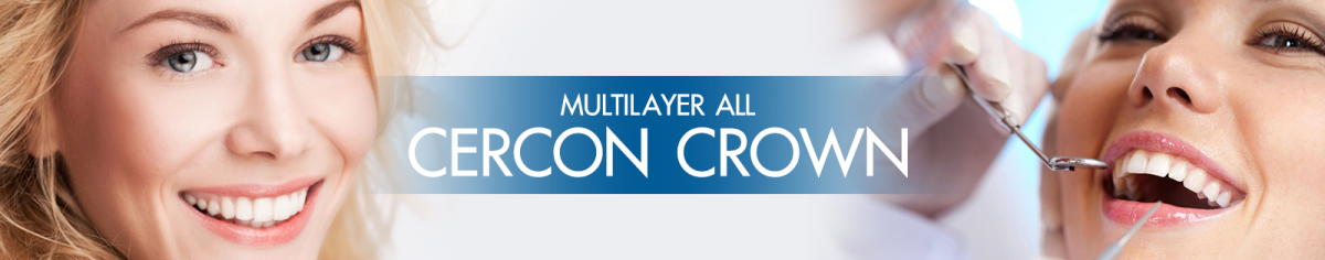 MULTILAYER ALL CERCON CROWN เส้นทางสายใหม่ของ ALL CERAMIC CROWN ความสวย ...